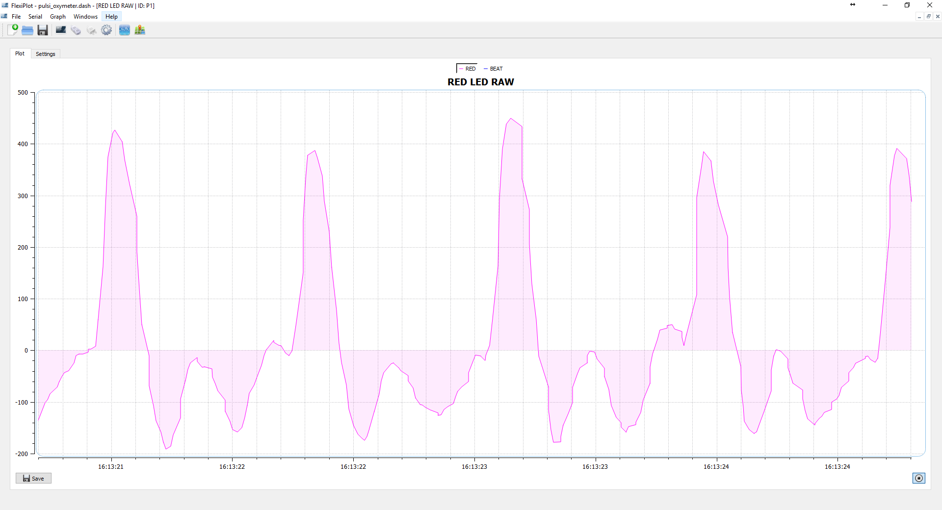 Implementing Pulse Oximeter Using Max30100 Morf Coding And Engineering