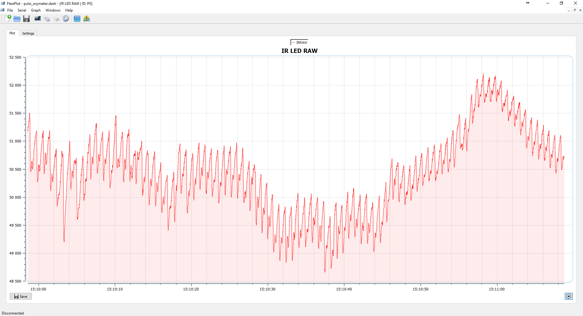 Implementing Pulse Oximeter Using Max30100 Morf Coding And Engineering