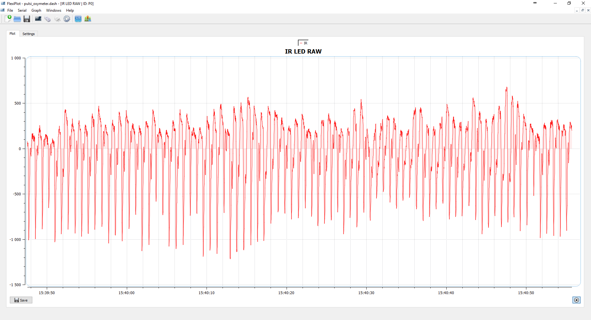 Implementing Pulse Oximeter Using Max30100 Morf Coding And Engineering